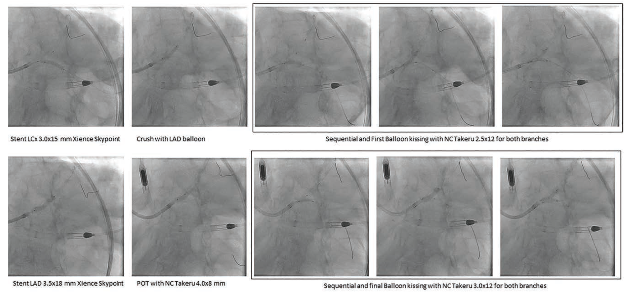 Making Complex Simple